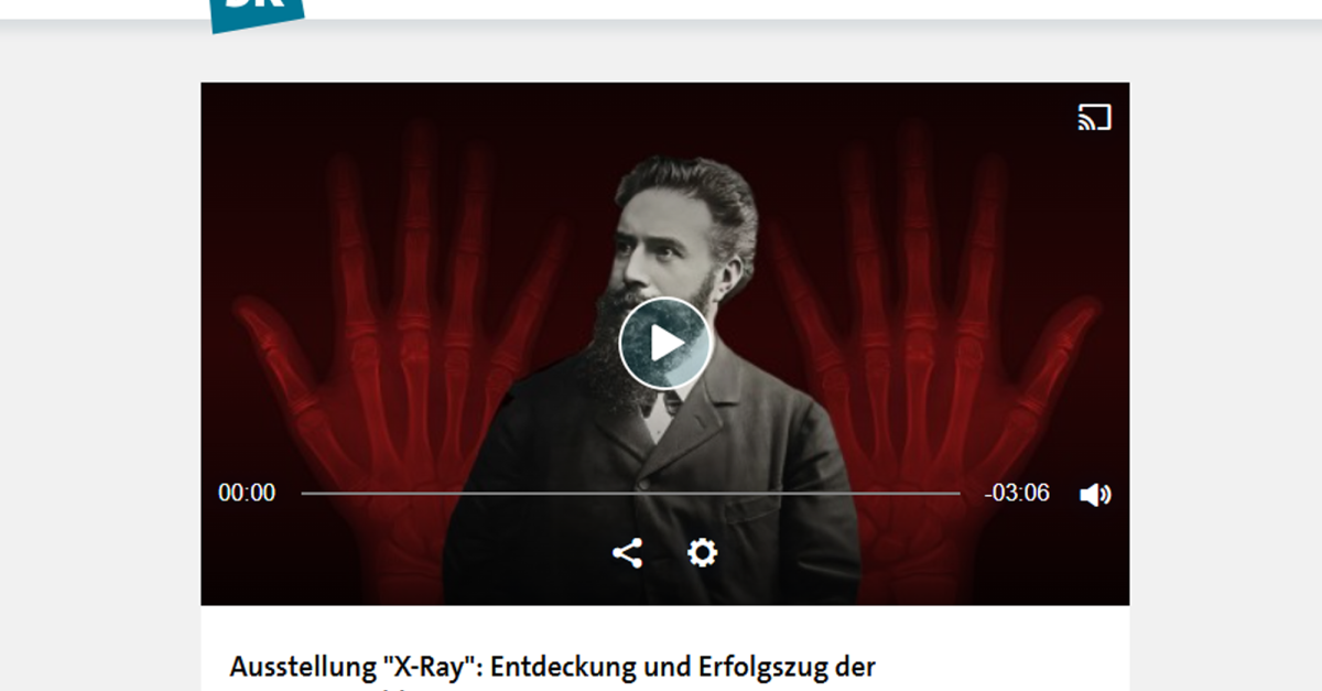 Ausstellung "X-Ray": Entdeckung und Erfolgszug der Röntgenstrahlung ...